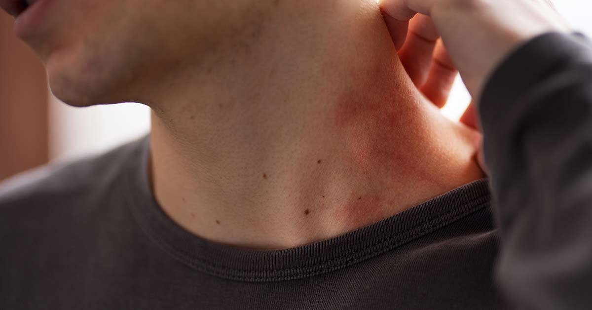 Câncer de Pele de Cabeça e Pescoço: Detalhes da Cirurgia