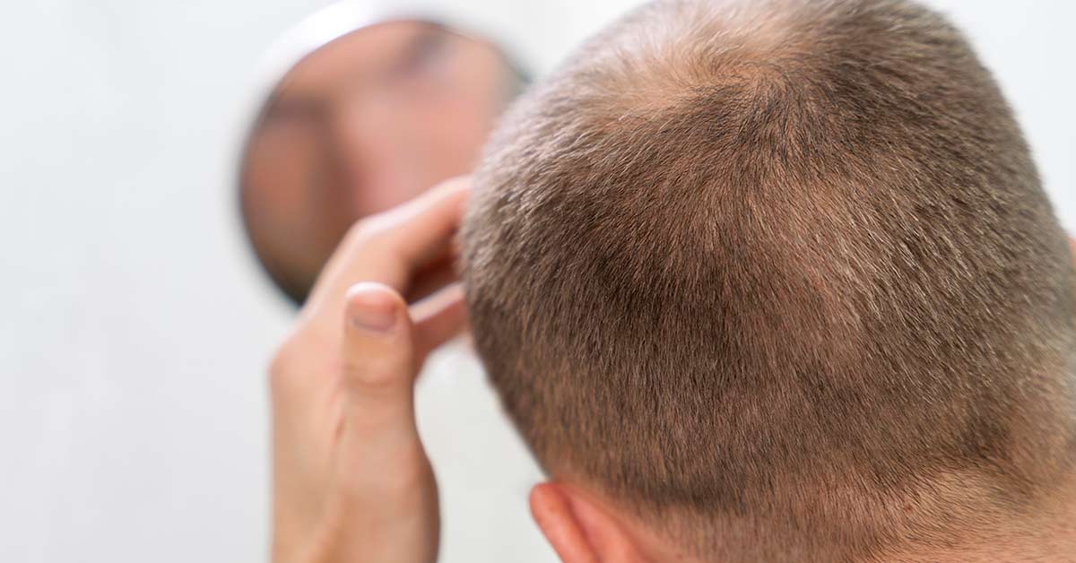 Tratamento de Câncer de Pele na Cabeça e Pescoço: opções